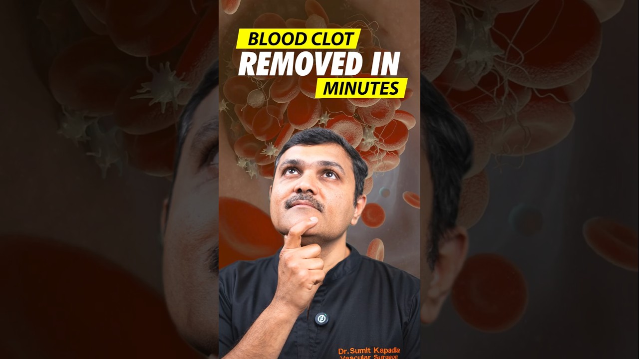 Peripheral Arterial Disease vs Peripheral Vascular Disease