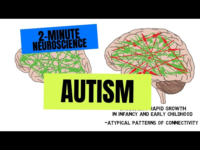 What Part Of The Body Does Autism Affect Here On The Spectrum